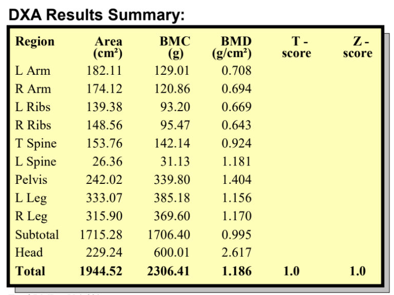 Interpreting DEXA Scan Results: A Comprehensive Guide